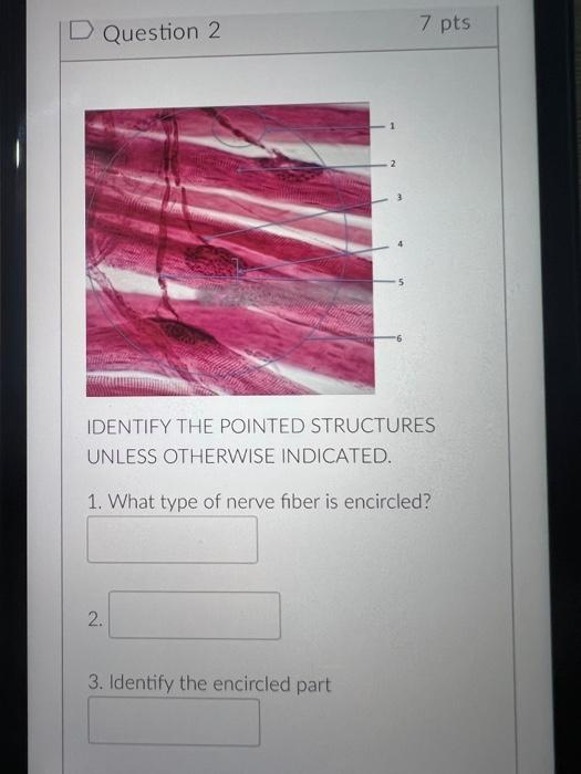 Solved D Question 2 7 pts 2 IDENTIFY THE POINTED STRUCTURES | Chegg.com