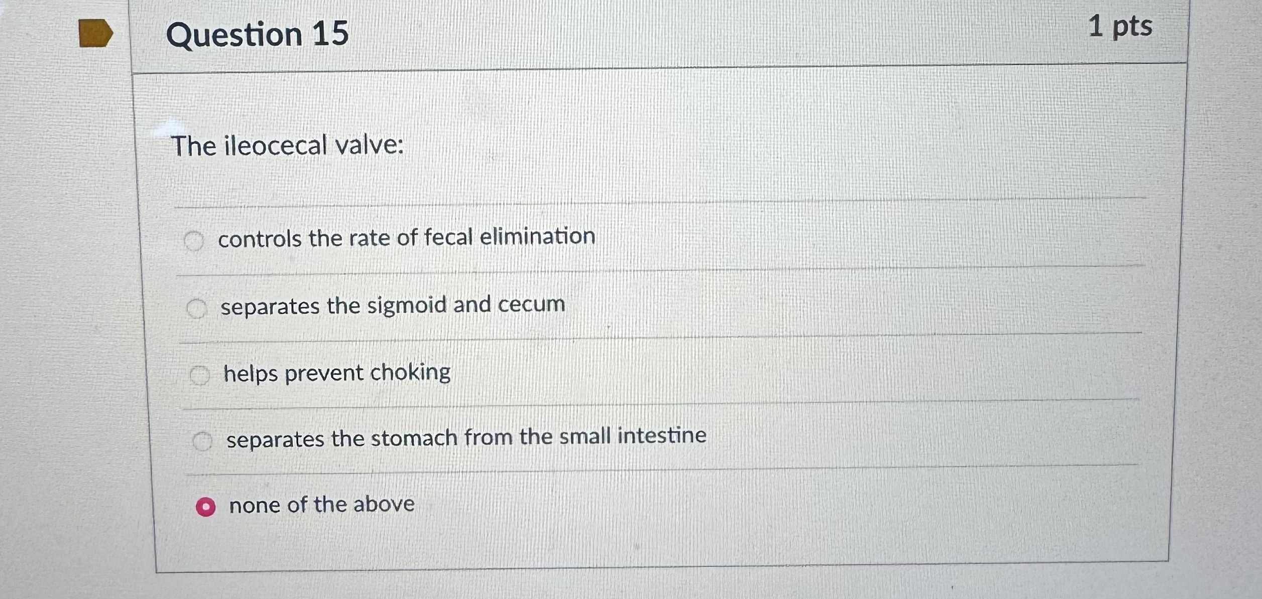 Solved Question 151 ﻿ptsThe ileocecal valve:controls the | Chegg.com