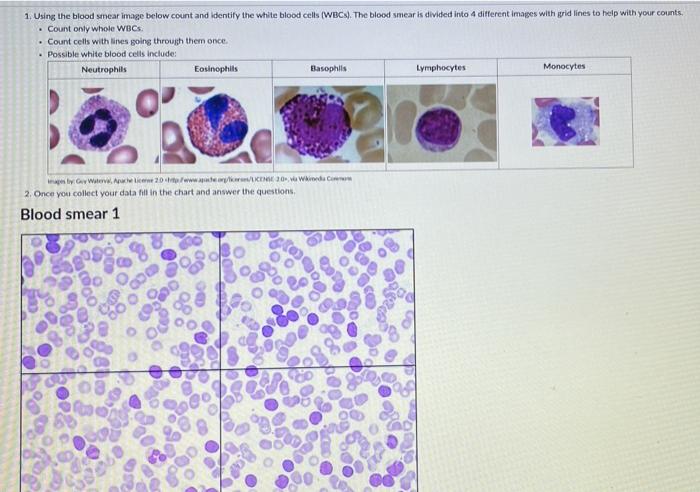 1. Using the blood smear image below count and | Chegg.com