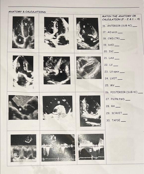 IV. THE TRANSTHORACIC ECHOCARDIOGRAM (TTE) DIMENSIONS | Chegg.com