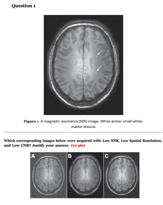 Solved Which corresponding images below were acquired with: | Chegg.com
