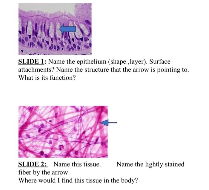 Solved SLIDE 1: Name the epithelium (shape, layer). Surface | Chegg.com
