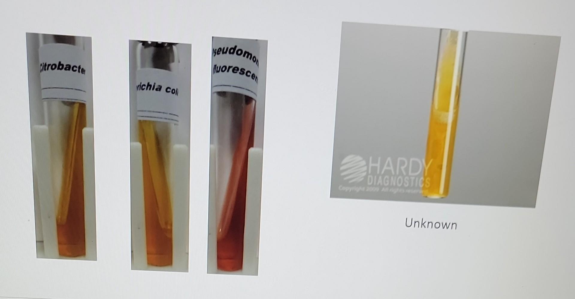 Solved Triple Sugar Iron Agar (TSI) - Slant contains | Chegg.com