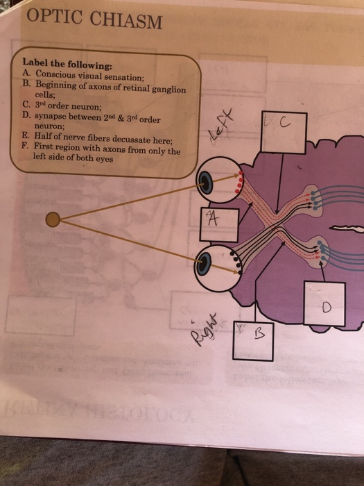 Solved OPTIC CHIASM Label the following: A. Conscious visual | Chegg.com