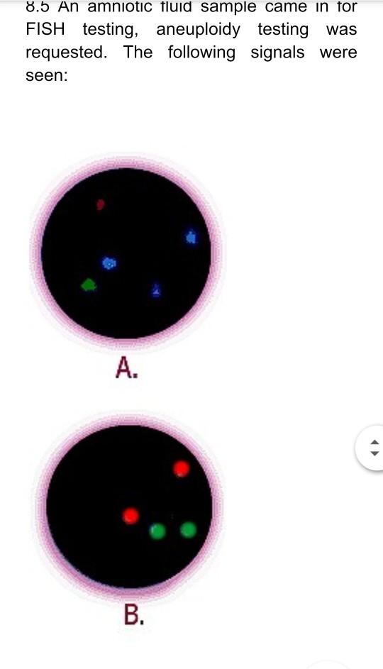 Solved 8.5 An amniotic fluid sample came in for FISH | Chegg.com