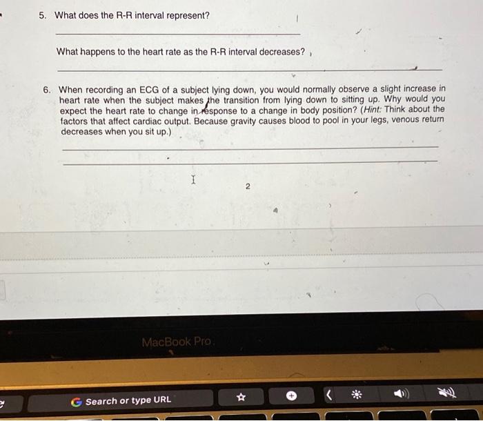 Solved 5. What does the R-R interval represent? What happens | Chegg.com