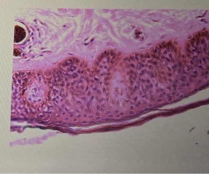 Solved Identify the tissue at the apical surfaces of the | Chegg.com