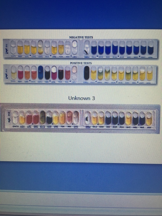 Exercise 8 Use Of The Api 20e System To Identify Gram