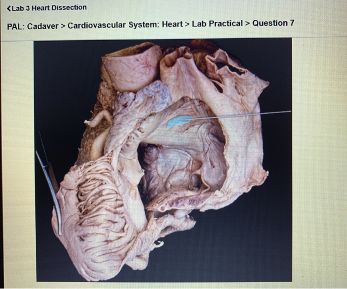 Solved Cardiovascular System: Heart > Lab Practical > | Chegg.com