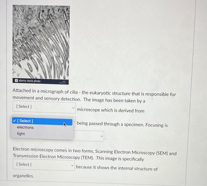 Solved a alamy stock photo Attached in a micrograph of cilia | Chegg.com