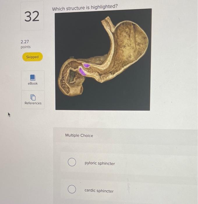 Solved Which structure is highlighted? 35 2.27 points | Chegg.com