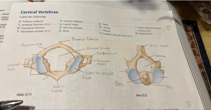 Atlas (C1) Axis (C2) | Chegg.com