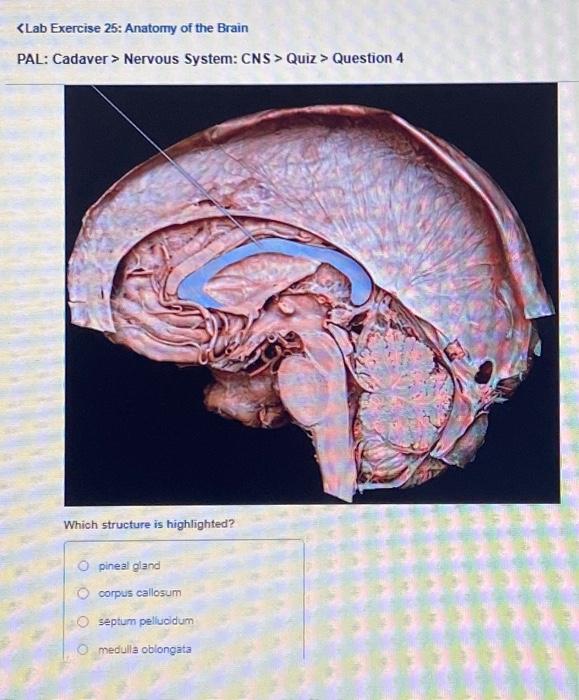 Solved Nervous System: CNS > Quiz > Question 19 Which | Chegg.com