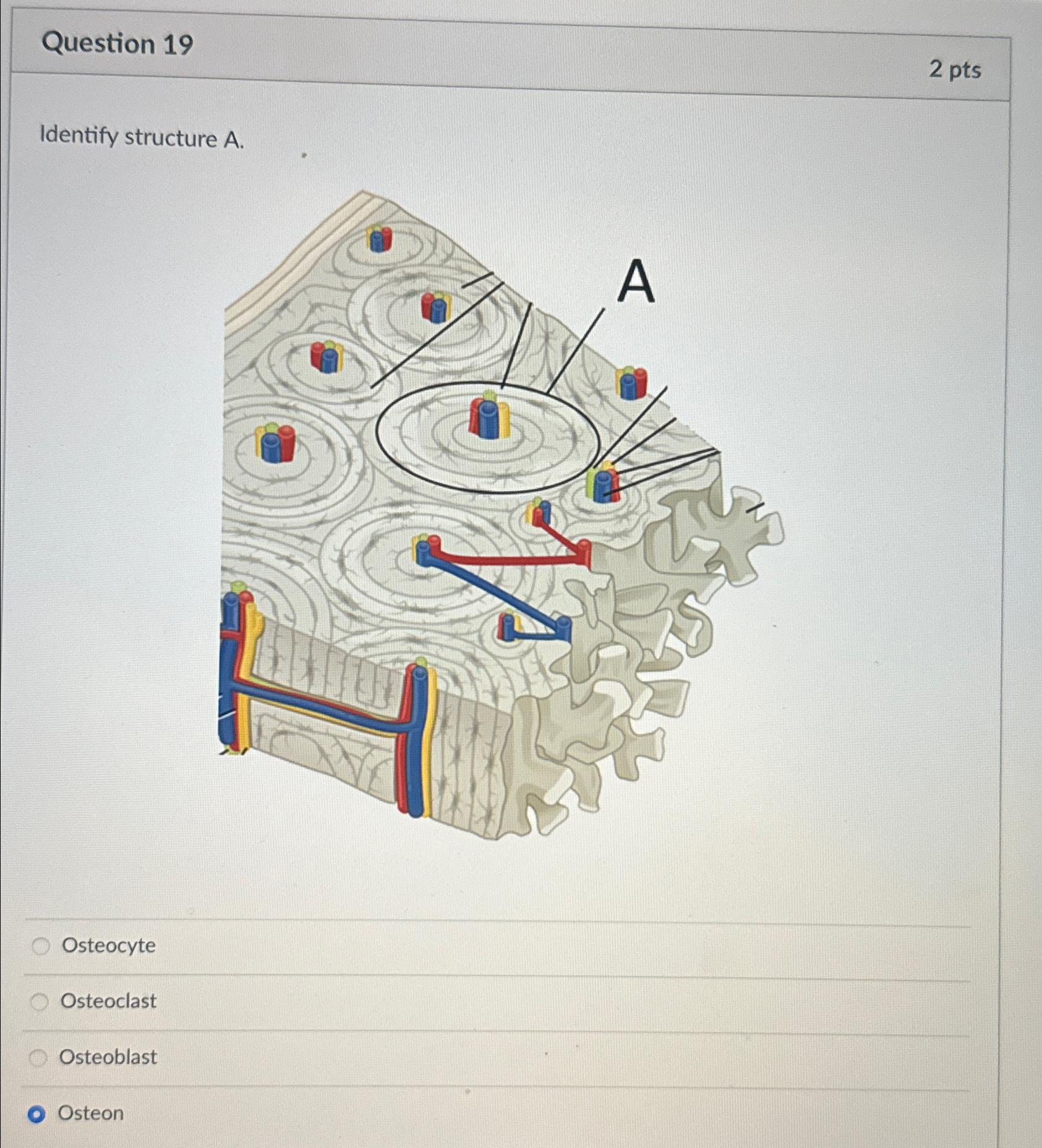 Solved Question 192 ﻿ptsIdentify structure | Chegg.com