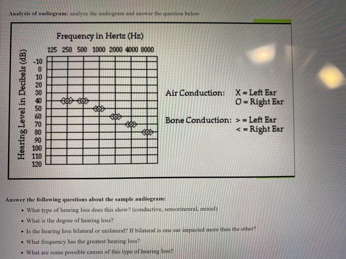 Solved Analysis of audiogram: analyze the audiogram and | Chegg.com