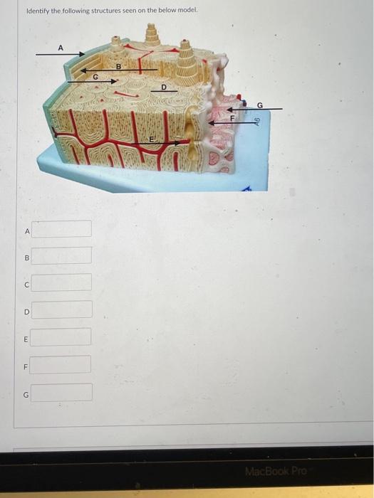 Solved Identify the following structures seen on the below | Chegg.com