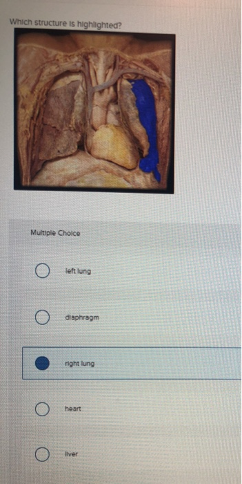 Solved Which structure is highlighted? Multiple Choice ο | Chegg.com