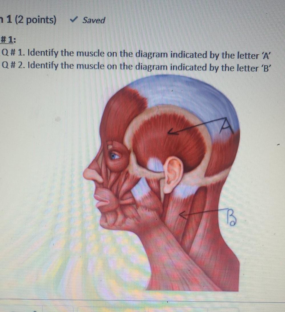 Solved 1 (2 points) Saved # 1: Q# 1. Identify the muscle on | Chegg.com