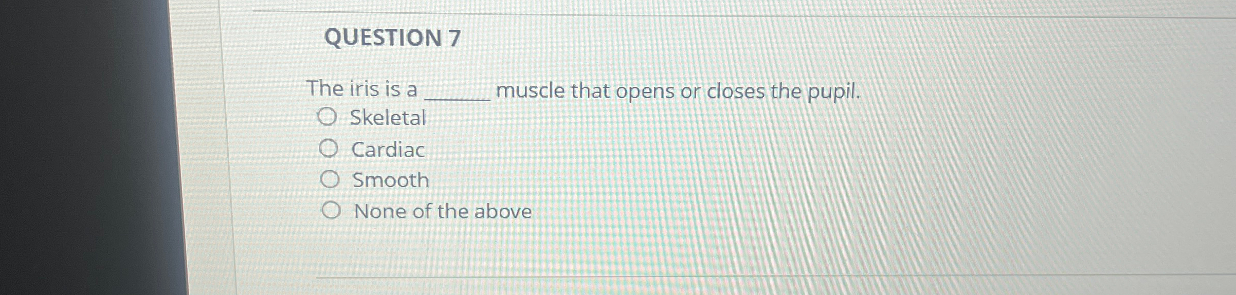 Solved QUESTION 7The iris is a q, ﻿muscle that opens or | Chegg.com