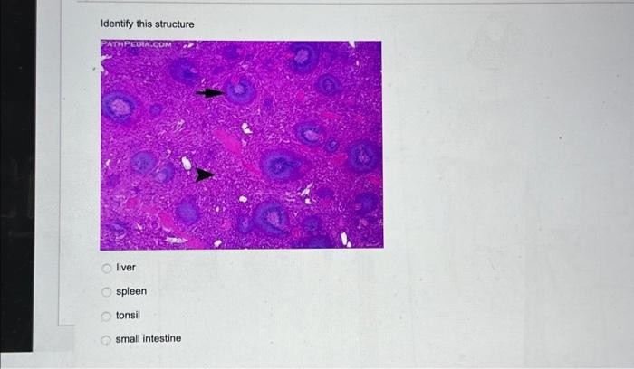 Solved Identify this structure liver spleen tonsil | Chegg.com