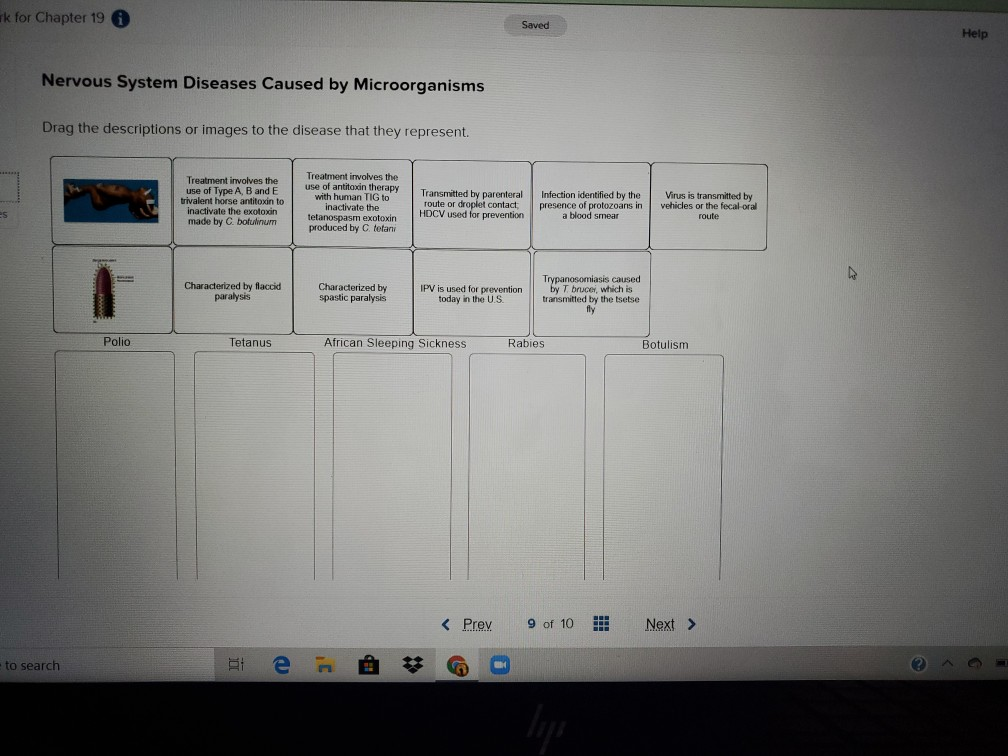 Solved ak for Chapter 19 Saved Help Nervous System Diseases | Chegg.com