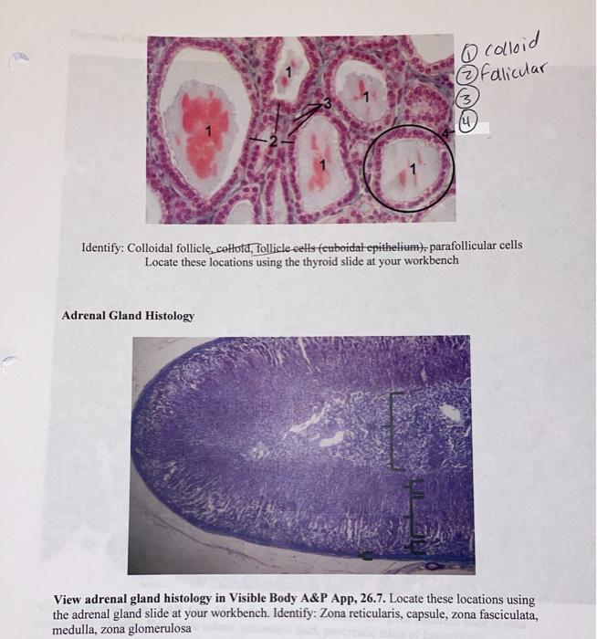 Solved 2 1 colloid & falicular (3 14 Identify: Colloidal | Chegg.com