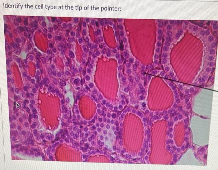 Solved Identify the cell type at the tip of the pointer: | Chegg.com