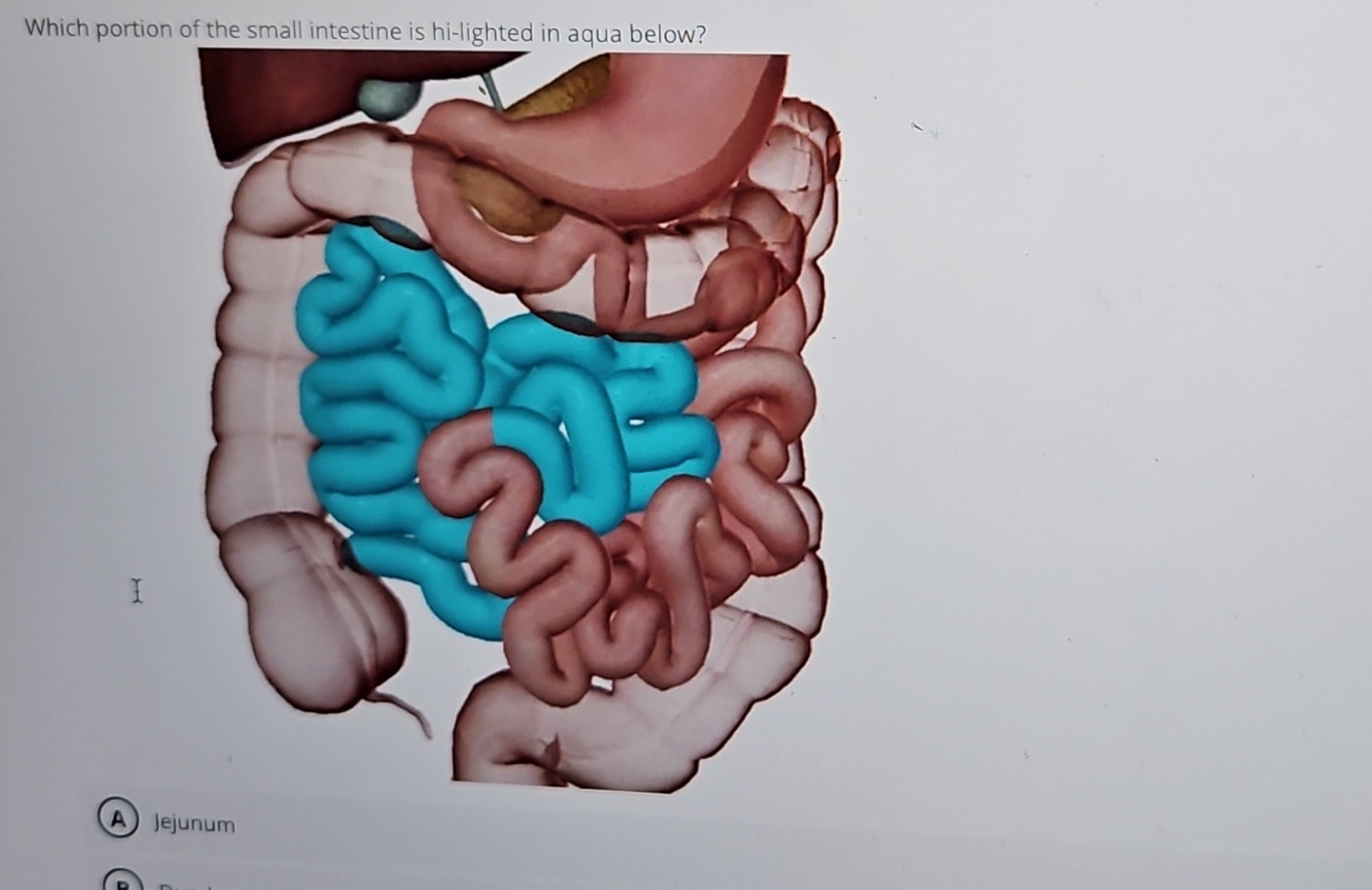 Solved Which portion of the small intestine is hi-lighted in | Chegg.com