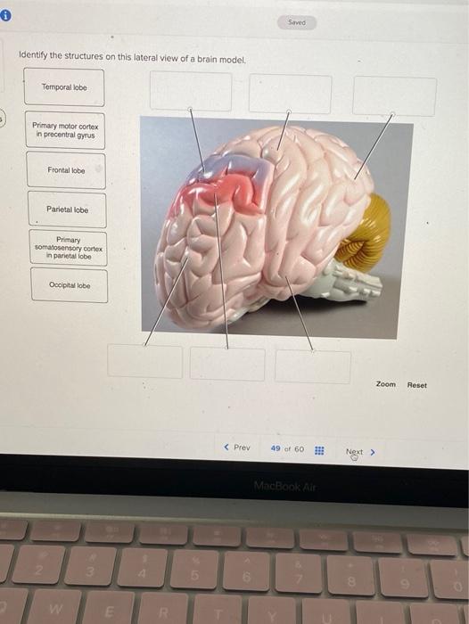 Solved saved Identify the structures on this midsagittal | Chegg.com