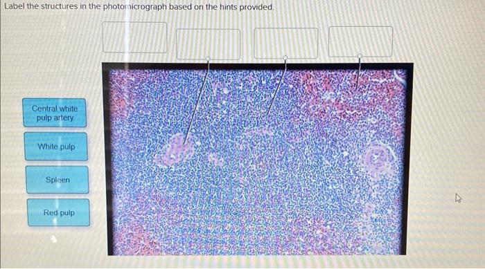 Solved Label the structures in the photomicrograph based on | Chegg.com