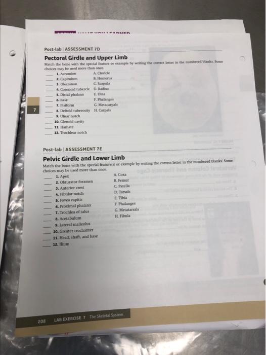 Solved RE Post-lab ASSESSMENT 7D Pectoral Girdle and Upper | Chegg.com