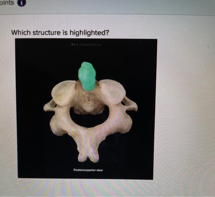 Solved Which structure is highlighted? Superior en Lateral | Chegg.com