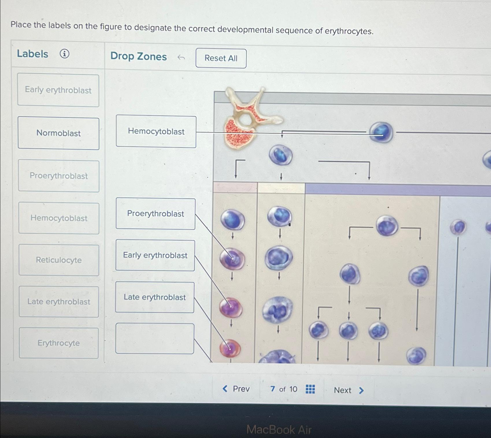 Solved Place the labels on the figure to designate the | Chegg.com