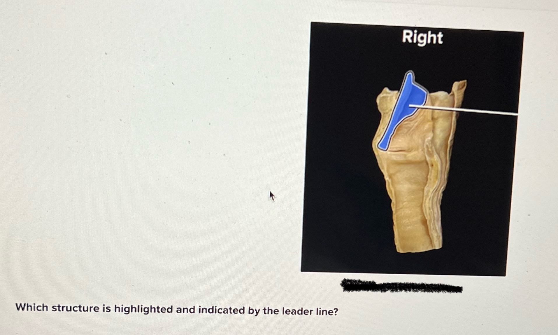 Solved Which structure is highlighted and indicated by the | Chegg.com