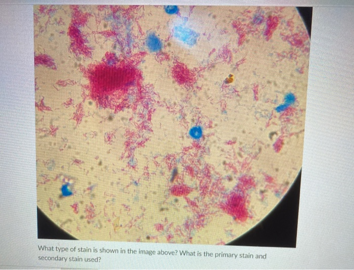 Solved What type of stain is shown in the image above? What | Chegg.com