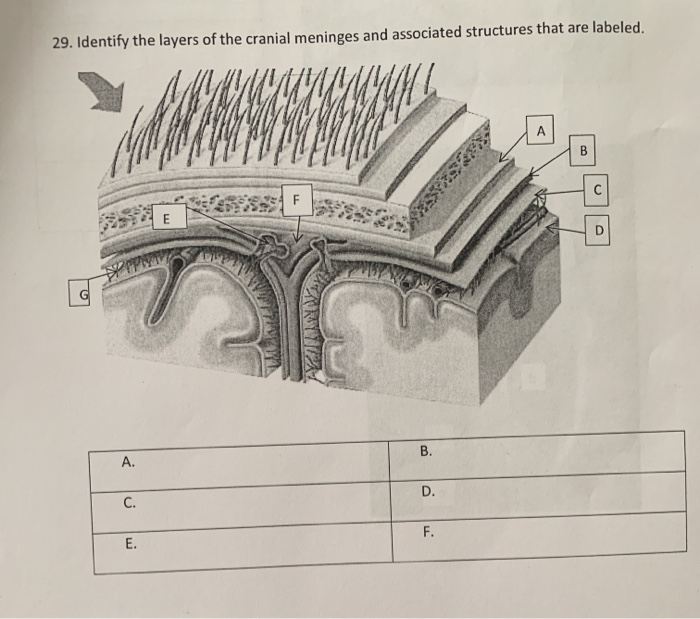 Solved 29. Identify the layers of the cranial meninges and | Chegg.com