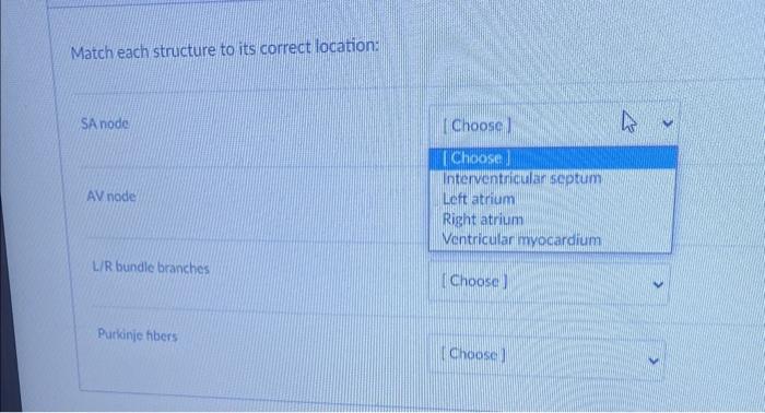 Solved Match each structure to its correct location: SAnode | Chegg.com
