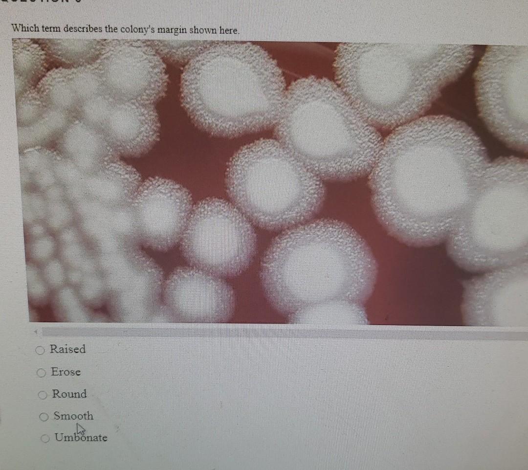 Solved Which term describes the colony's margin shown here. | Chegg.com