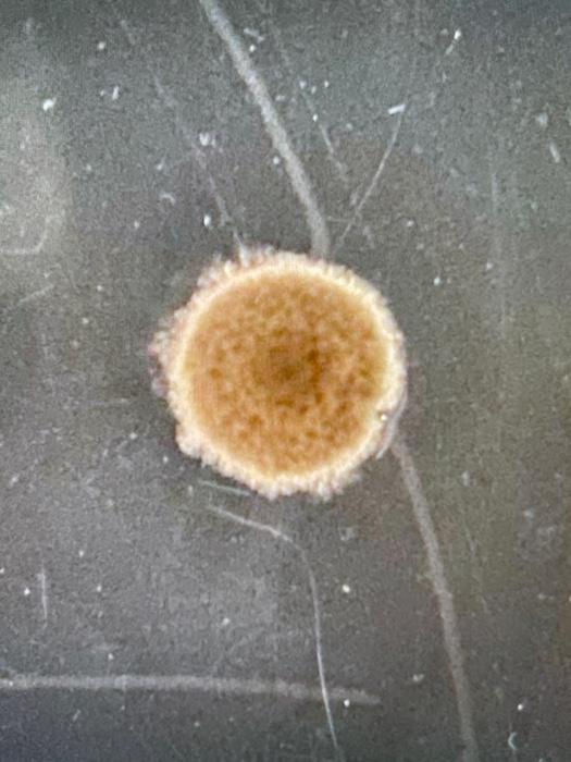 identify the type mold and colony description ( | Chegg.com