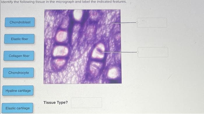 Solved Identify the following tissue in the micrograph and | Chegg.com