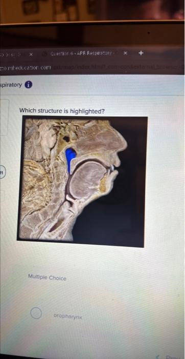 Solved Which structure is highlighted? Multiple Choice | Chegg.com