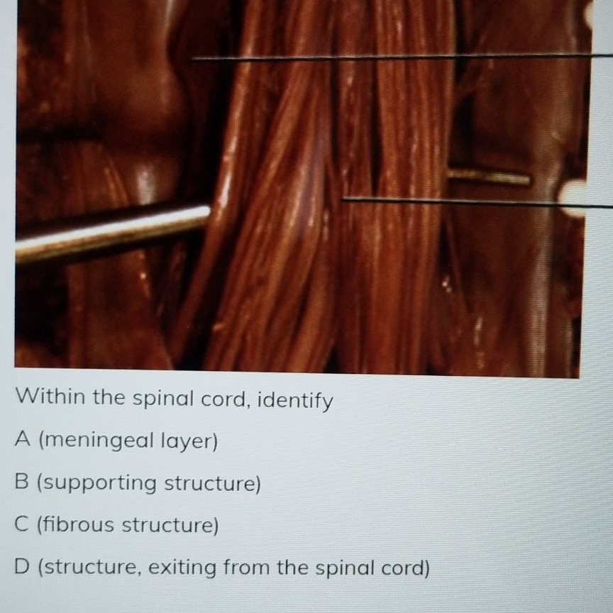 Solved Dissected view of vertebral canal showing caudal end | Chegg.com