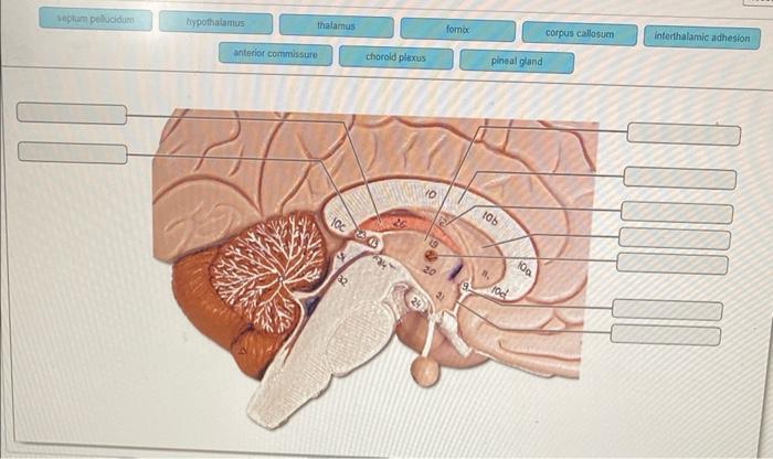 please match all 4 questions label exercises1)2)3)4) | Chegg.com