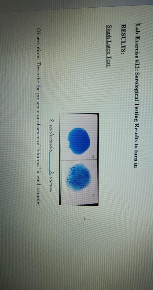 Solved Lab Exercise #12: Serological Testing Results to turn | Chegg.com