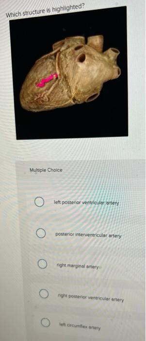 Solved Multiple Choice left posterior ventricular artery | Chegg.com