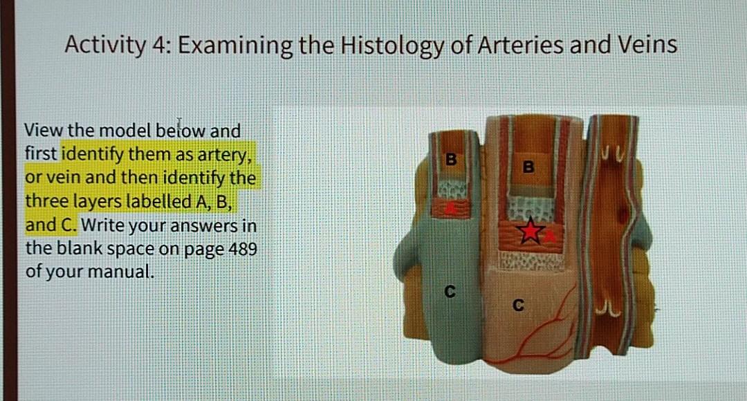 Solved Activity 4: Examining the Histology of Arteries and | Chegg.com