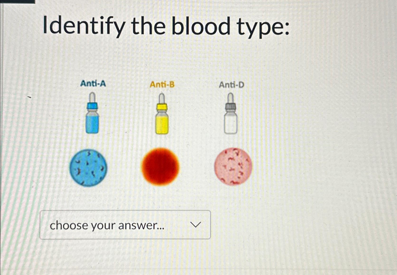 Solved Identify the blood type:Anti-AAnti-B | Chegg.com