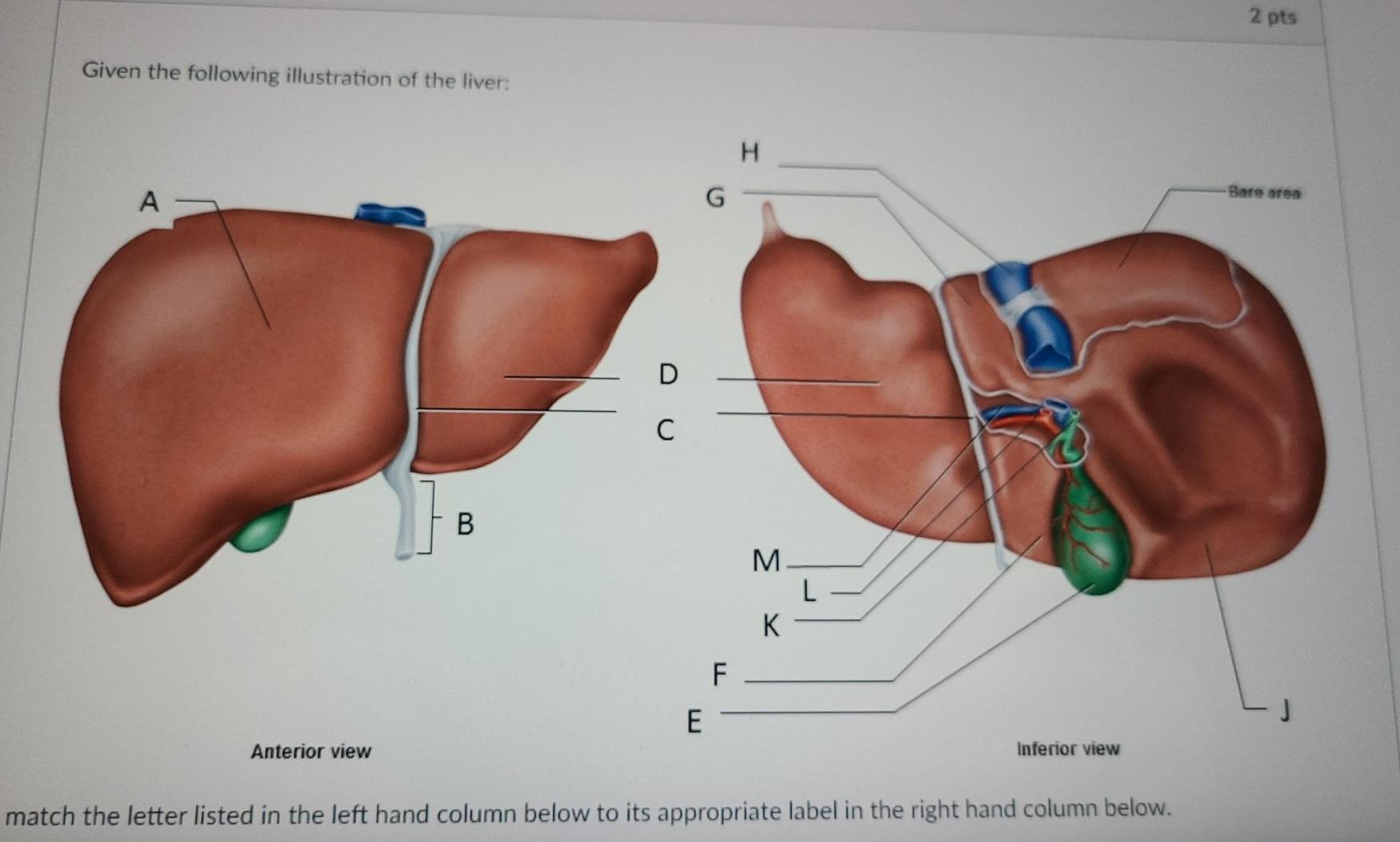 Solved 2 pts Given the following illustration of the liver: | Chegg.com