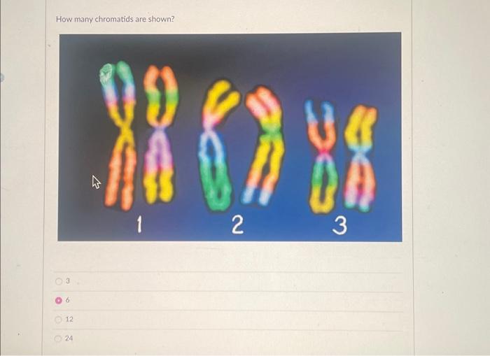 Solved How many chromatids are shown? | Chegg.com