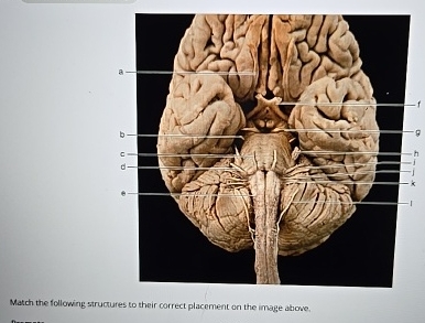 Solved Match the following structures to their correct | Chegg.com